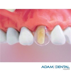 Dental Crown Forms - Adam Dental Supplies Australia