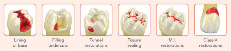 GC Solare Flo - Adam Dental Supplies Australia